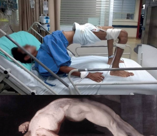 Medical Cases Archives - Page 2 of 144 - MEDizzy Journal