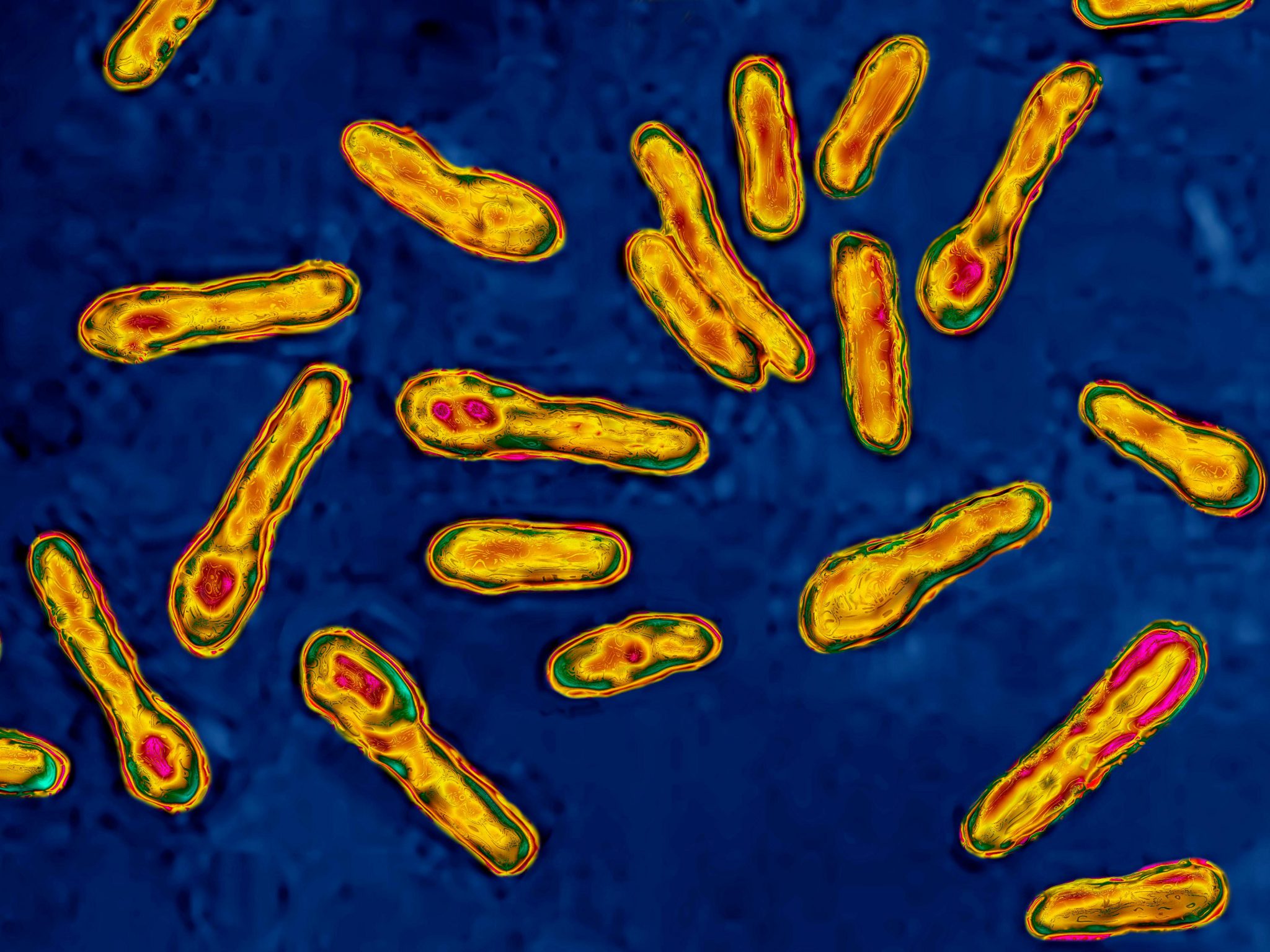 Hypotonic infant... Botulism - MEDizzy Journal