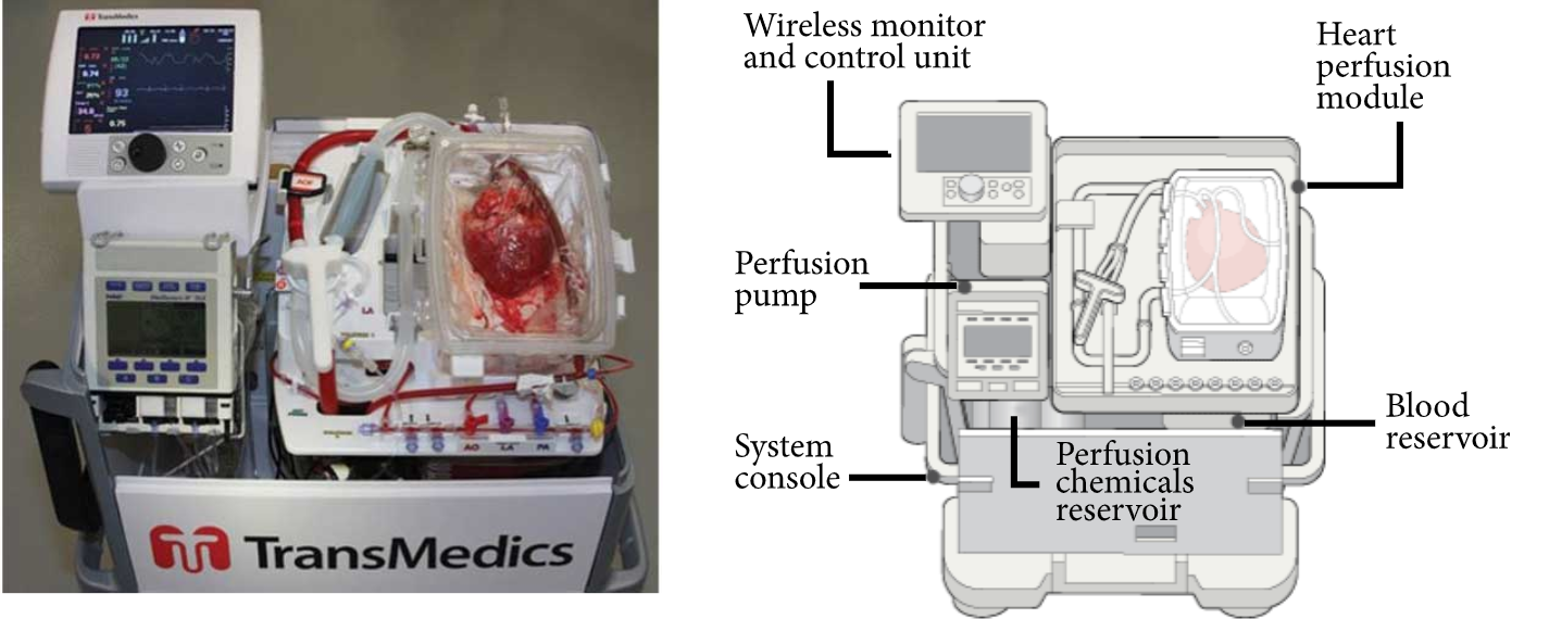 Heart Perfused Outside the Body! - MEDizzy Journal