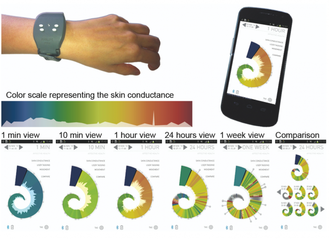 Sweat, a Mood Detector? - MEDizzy Journal