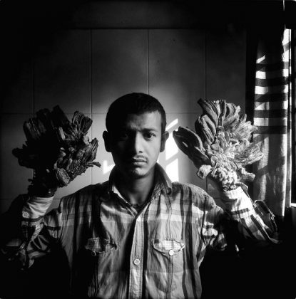 Tree Man in real or another Hollywood fantasy? - MEDizzy Journal