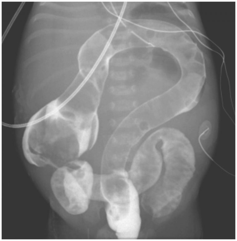 Colon With Question Mark Appearance - MEDizzy Journal