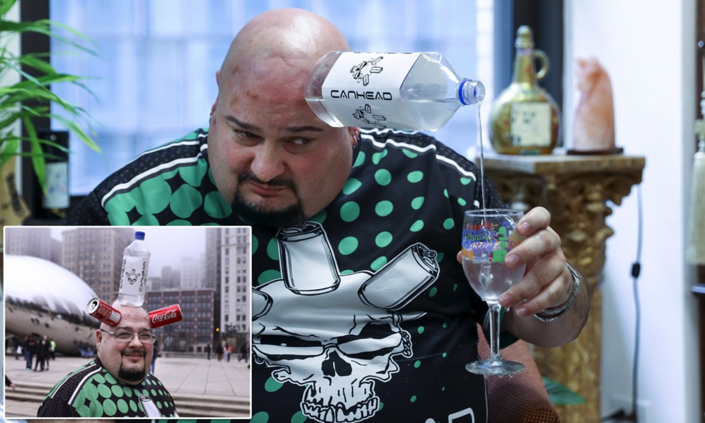 Human Suction Cup... His Skin Acts Like a Suction Cup - MEDizzy Journal