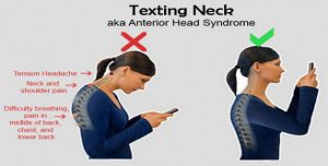 Text Neck... The Disease Of This Era! - MEDizzy Journal