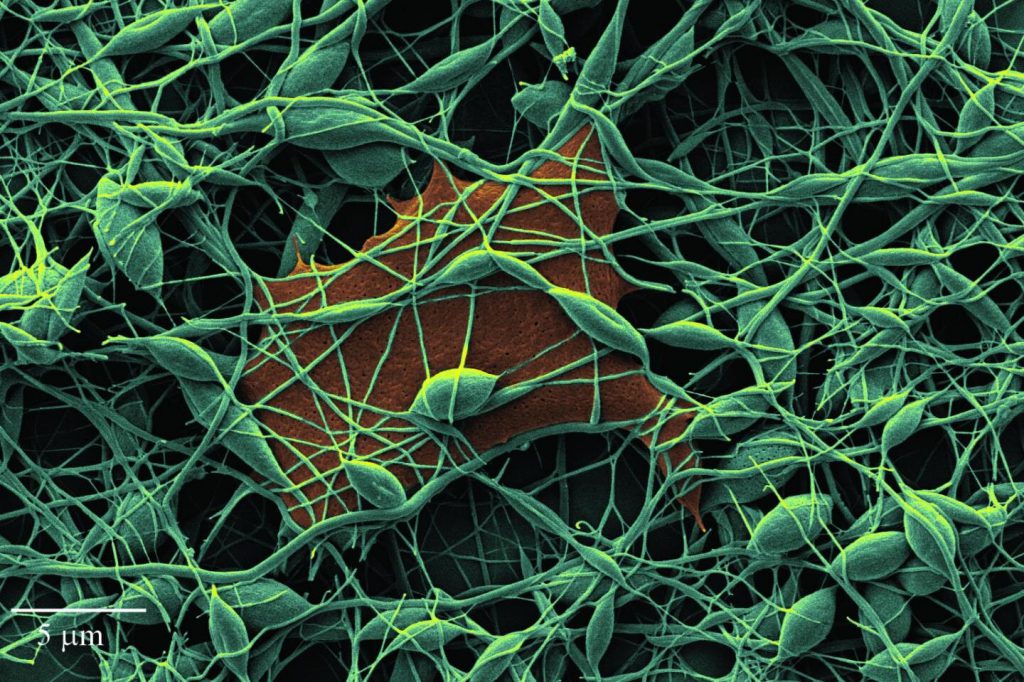 Wound Dressing Made of Diamonds! - MEDizzy Journal