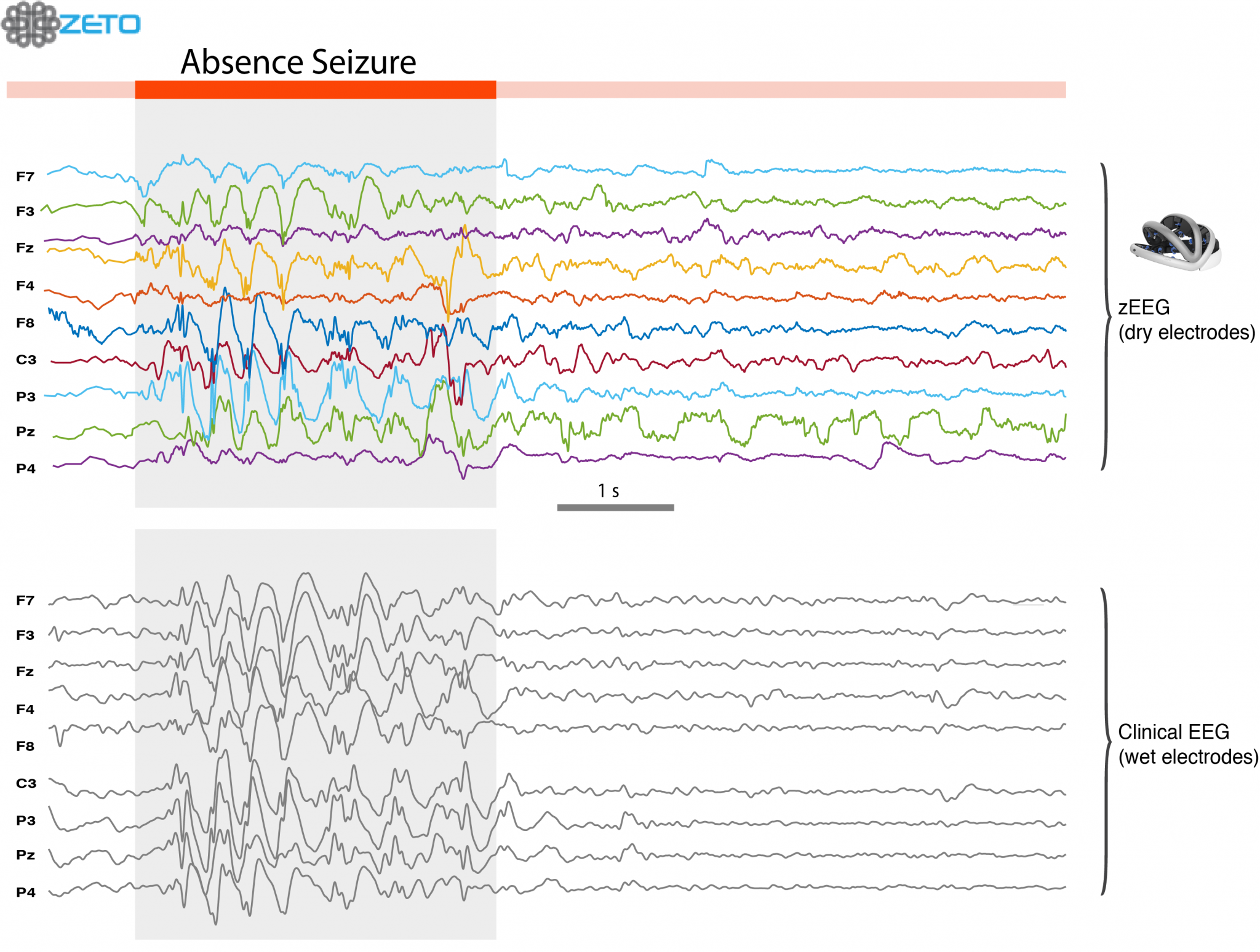 EEG Revolutionized - MEDizzy Journal