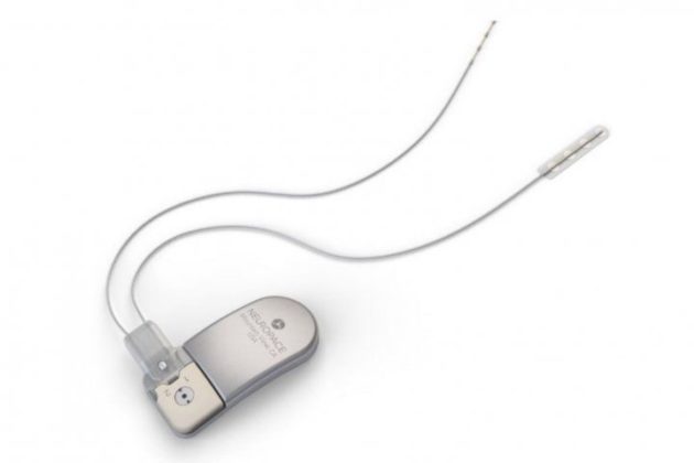 Researchers Predict Seizures Three Days in Advance - MEDizzy Journal