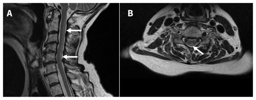 Complications Of Copper Deficiency - MEDizzy Journal