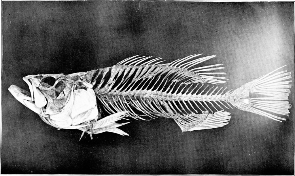 An unusual case of subcutaneous emphysema after fish bone ingestion