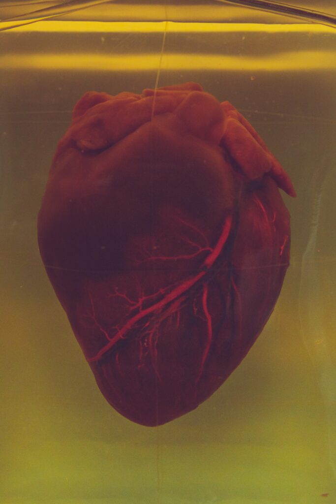 Mini Self-Organizing Heart Models - MEDizzy Journal