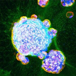 Scientists make Mini Lungs to test drugs for COVID-19 - MEDizzy Journal