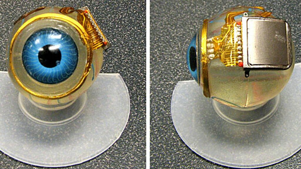 World's First Bionic Eye to Restore Vision in Blind Individuals ...
