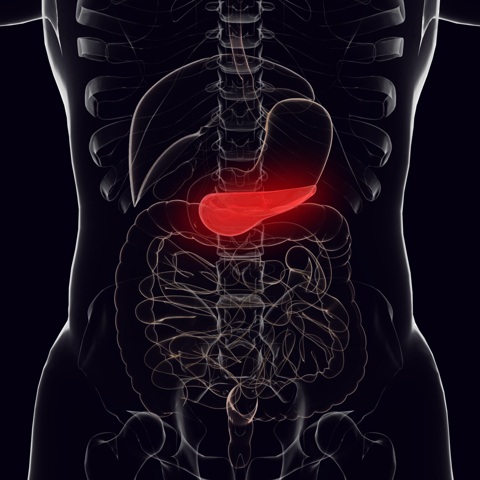 Experimental Treatment Shrinks Pancreatic Cancer - MEDizzy Journal